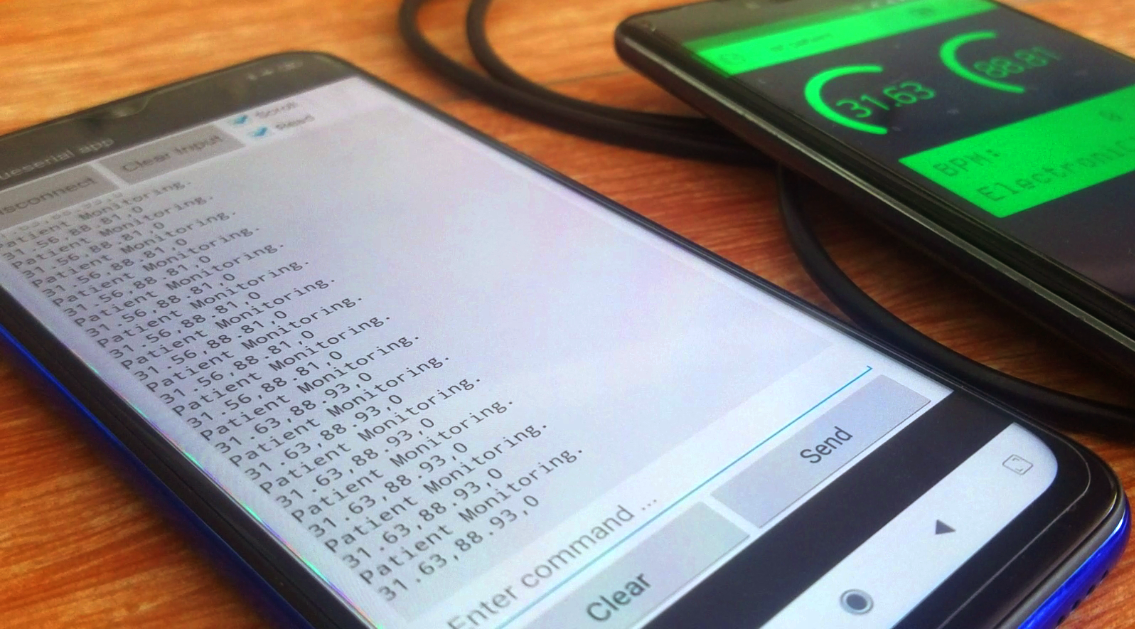 Iot Based Patient Monitoring System Using Esp8266 Arduino And Android